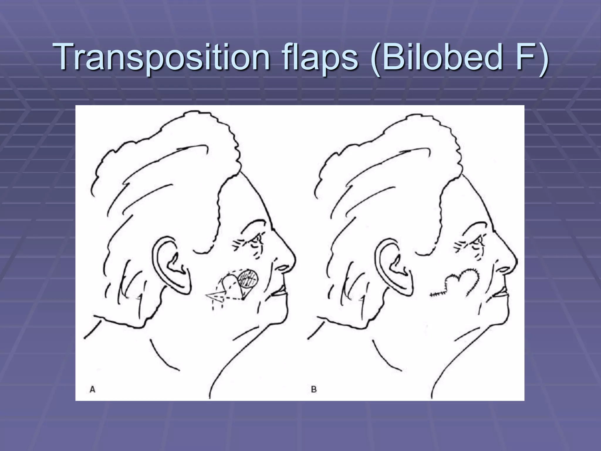 cheek-reconstruction-ppt.ppt | Death, Injury, or Military Conflict ...