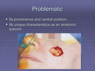 cheek-reconstruction-ppt.ppt