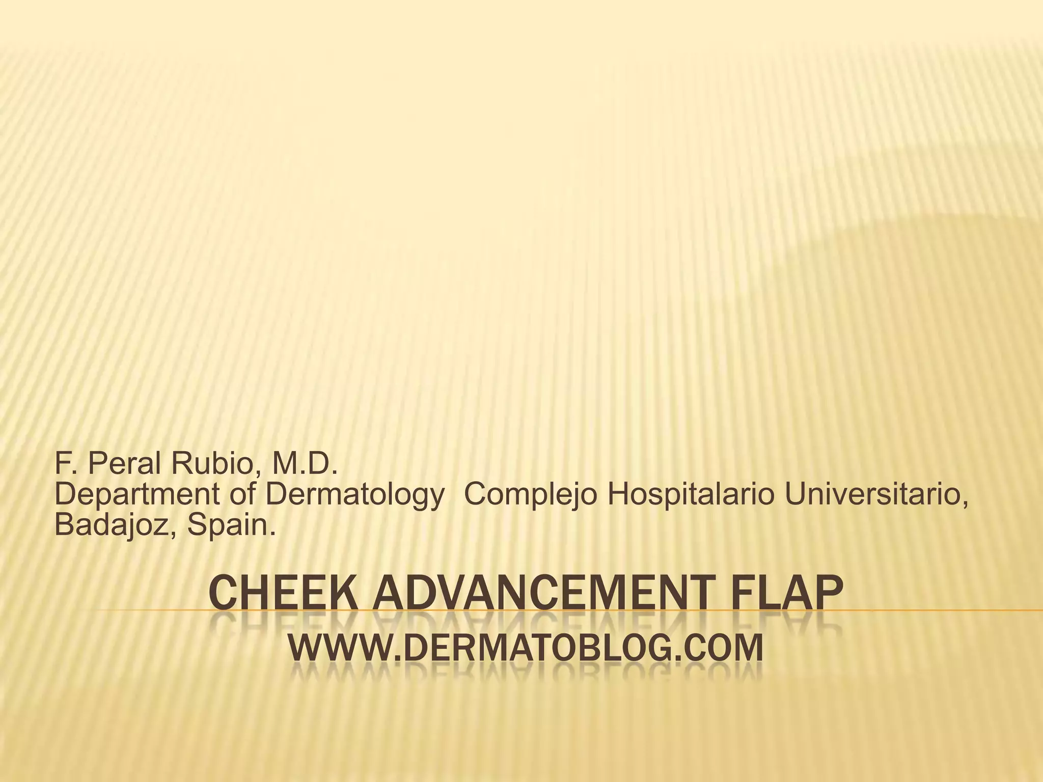 Cheek Advancement Flap | PPTX