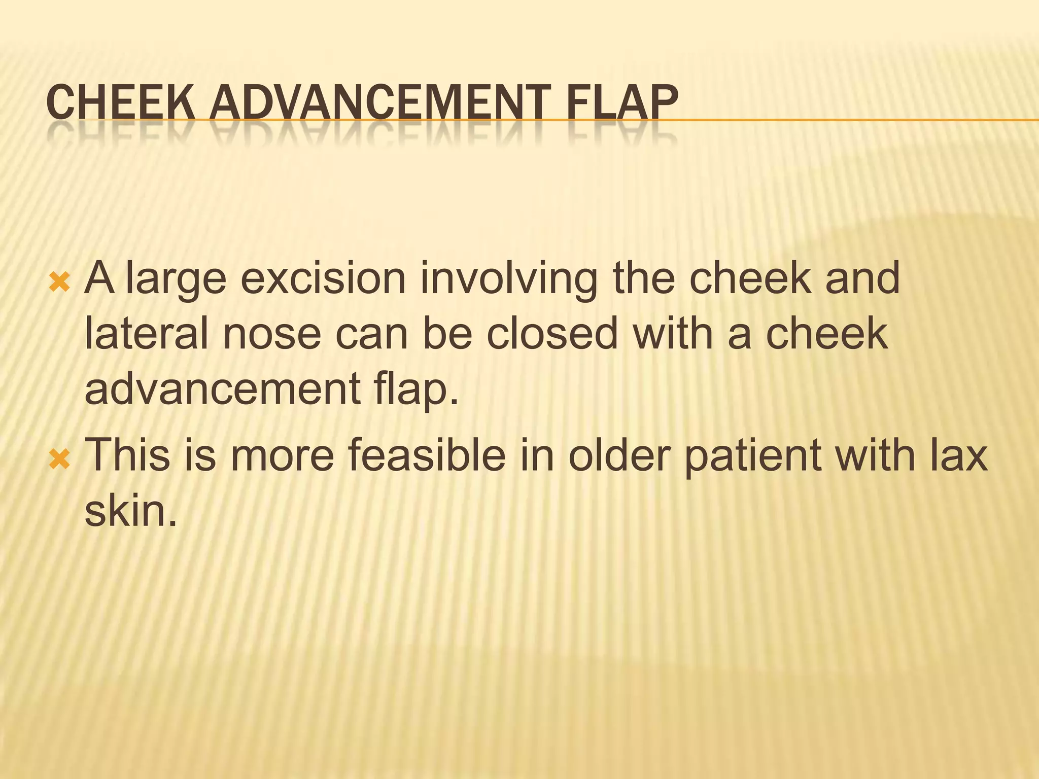Cheek Advancement Flap | PPTX