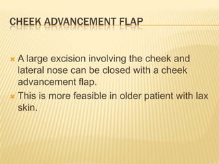 Cheek Advancement Flap | PPTX
