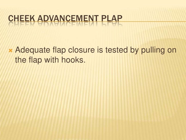Cheek Advancement Flap