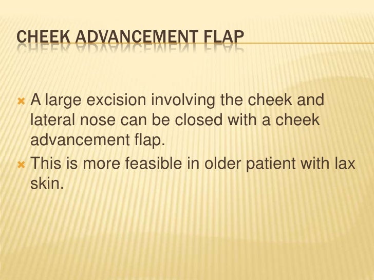 Cheek Advancement Flap