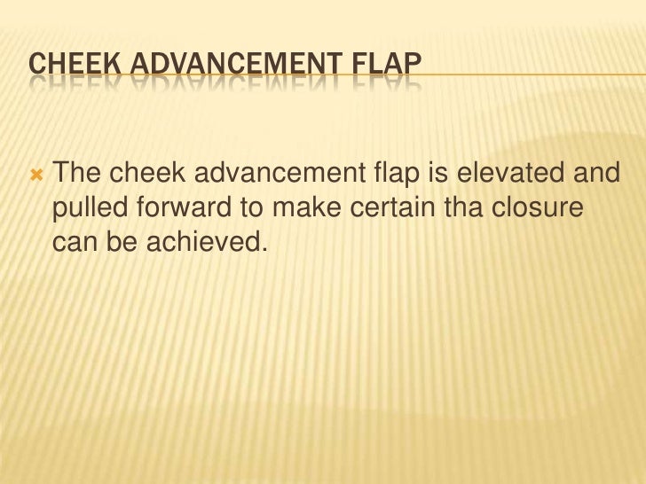 Cheek Advancement Flap