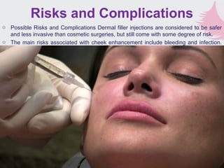 Cheek Fillers | PPT