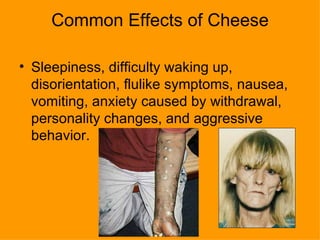 Cheese (recreational drug) erwin dane | PPT