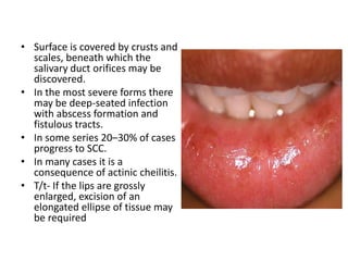 Infectious Cheilitis