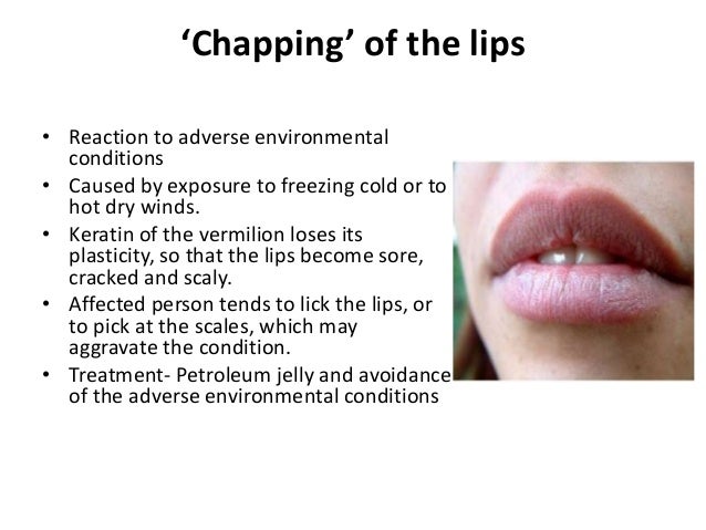 Common Causes Of Recurrent Lip Rashes Cheilitis