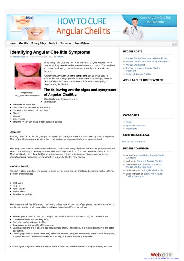 Angular Cheilitis Treatment | PDF | Infectious Diseases | Diseases and ...