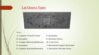 Cheiloscopy | PPTX