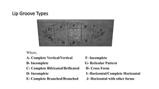 Cheiloscopy ppt. LIP PRINTING FORENSIC PATHOLOGY | PPTX