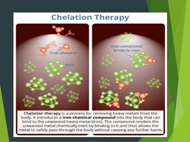 Chelation therapy