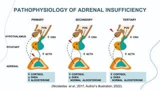 PATHOPHYSIOLOGY OF ADRENAL INSUFFICIENCY: A HORMONAL AND METABOLIC ...