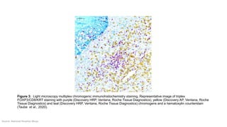 EXPLORING THE CONCEPT OF MULTIPLEXING IN IMMUNOHISTOCHEMISTRY | PPTX