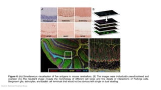 EXPLORING THE CONCEPT OF MULTIPLEXING IN IMMUNOHISTOCHEMISTRY | PPTX