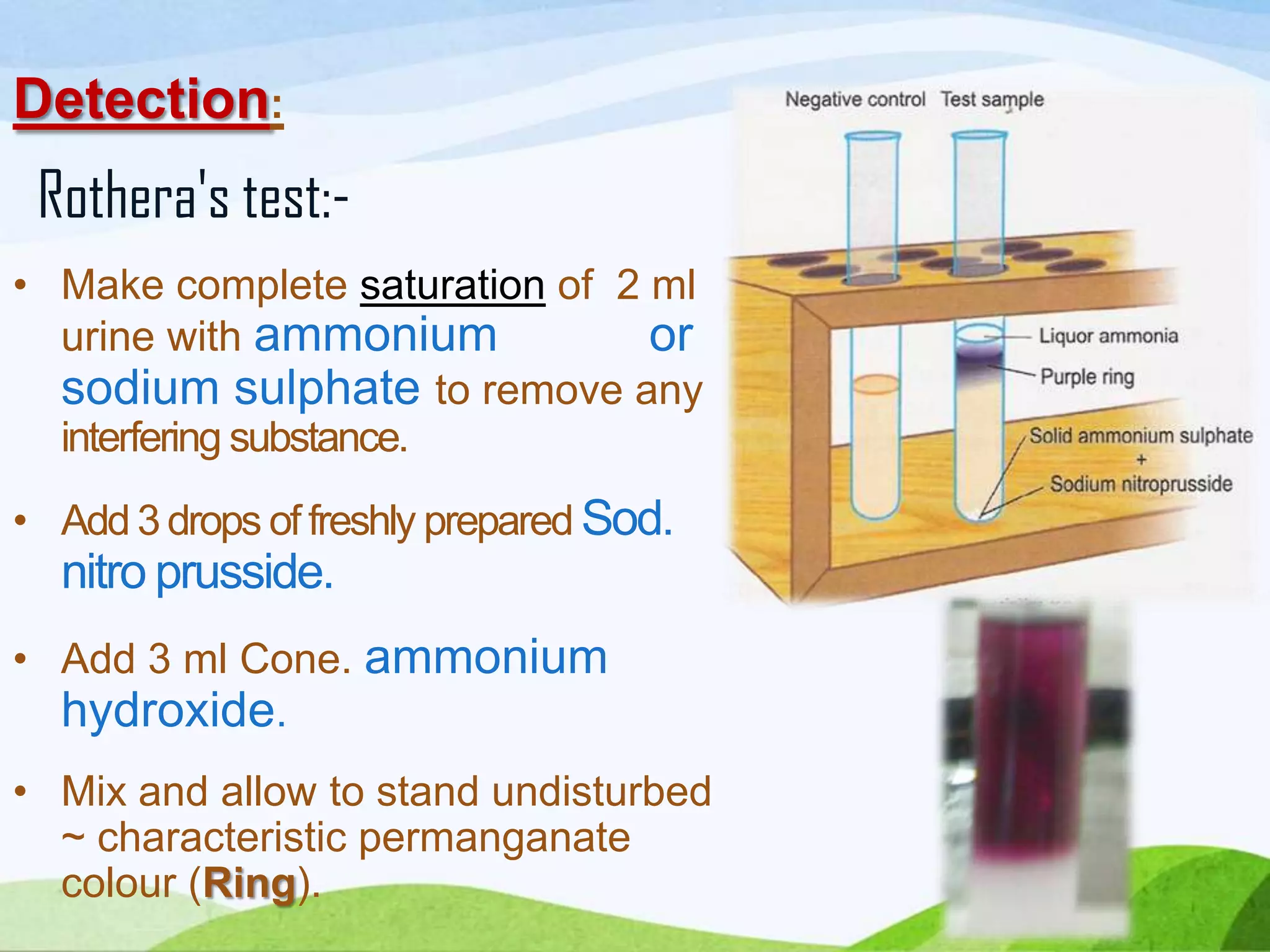 Chemical examination of urine | PPTX