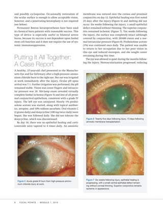 Chemical burn | PDF