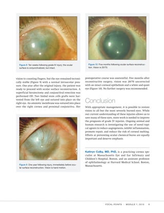 Chemical burn | PDF