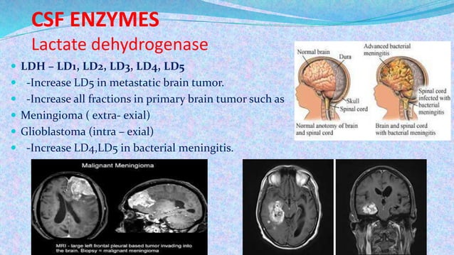 Chemical components of CSF analysis | PPTX | Brain and Nervous System ...