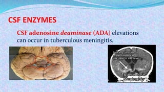 Chemical components of CSF analysis | PPTX