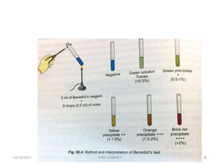 Chemical examination of urine | PPT