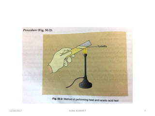 Chemical examination of urine | PPT