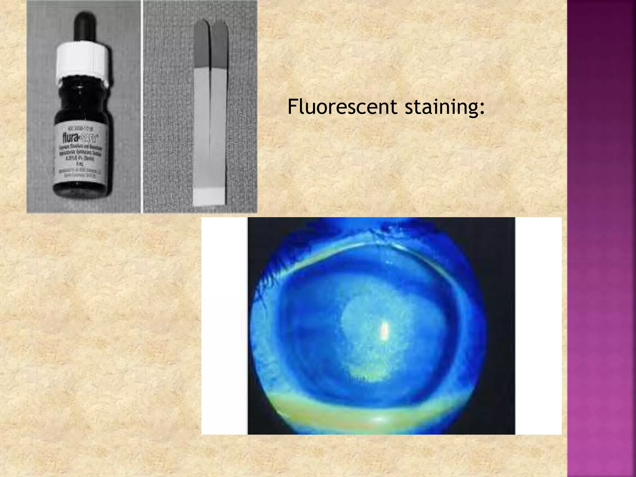 Chemical eye injuries ruhi.pptx