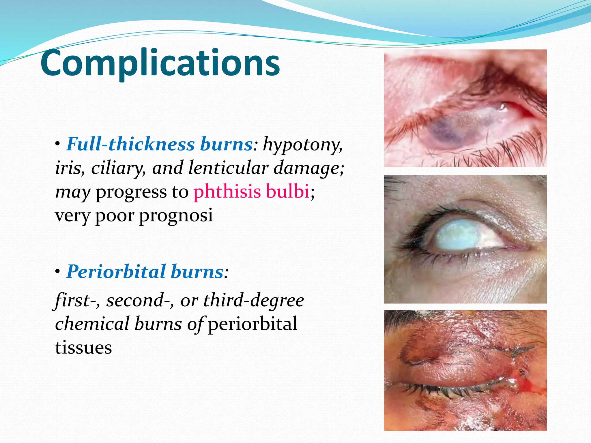 Chemical eye trauma, By Dr. Safaa Refaat | PPTX
