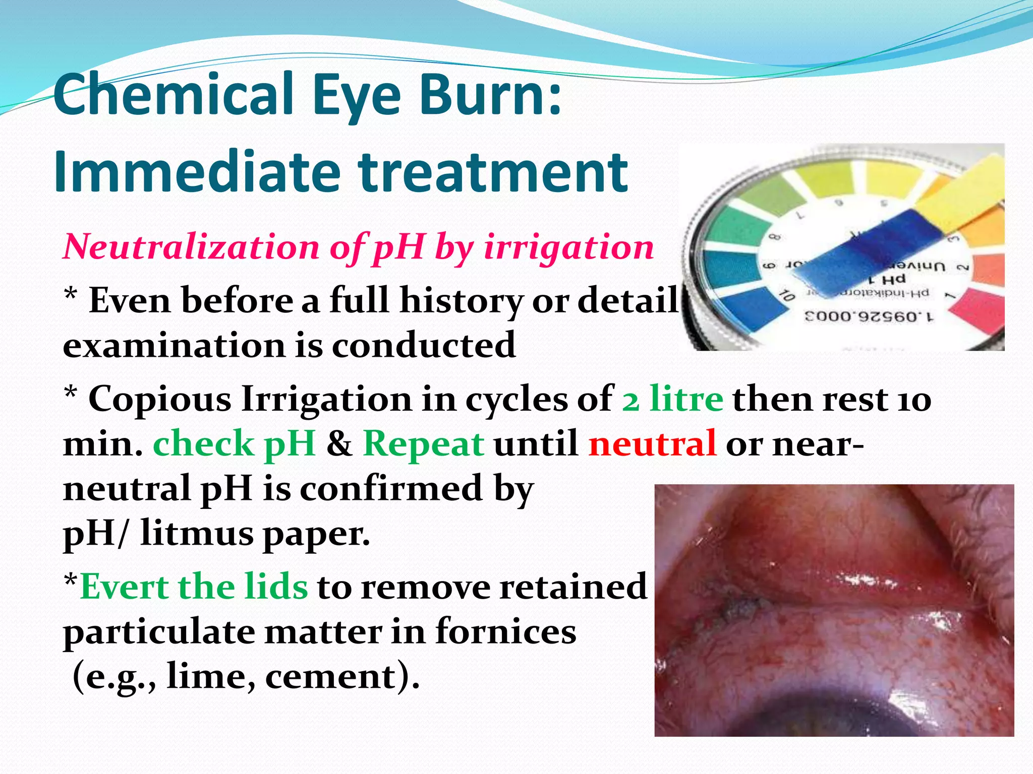 Chemical eye trauma, By Dr. Safaa Refaat | PPTX