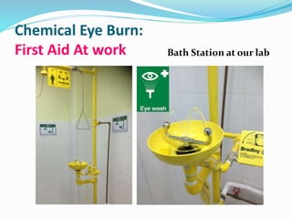 Chemical eye trauma, By Dr. Safaa Refaat | PPTX