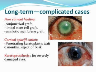 Chemical eye trauma, By Dr. Safaa Refaat | PPTX