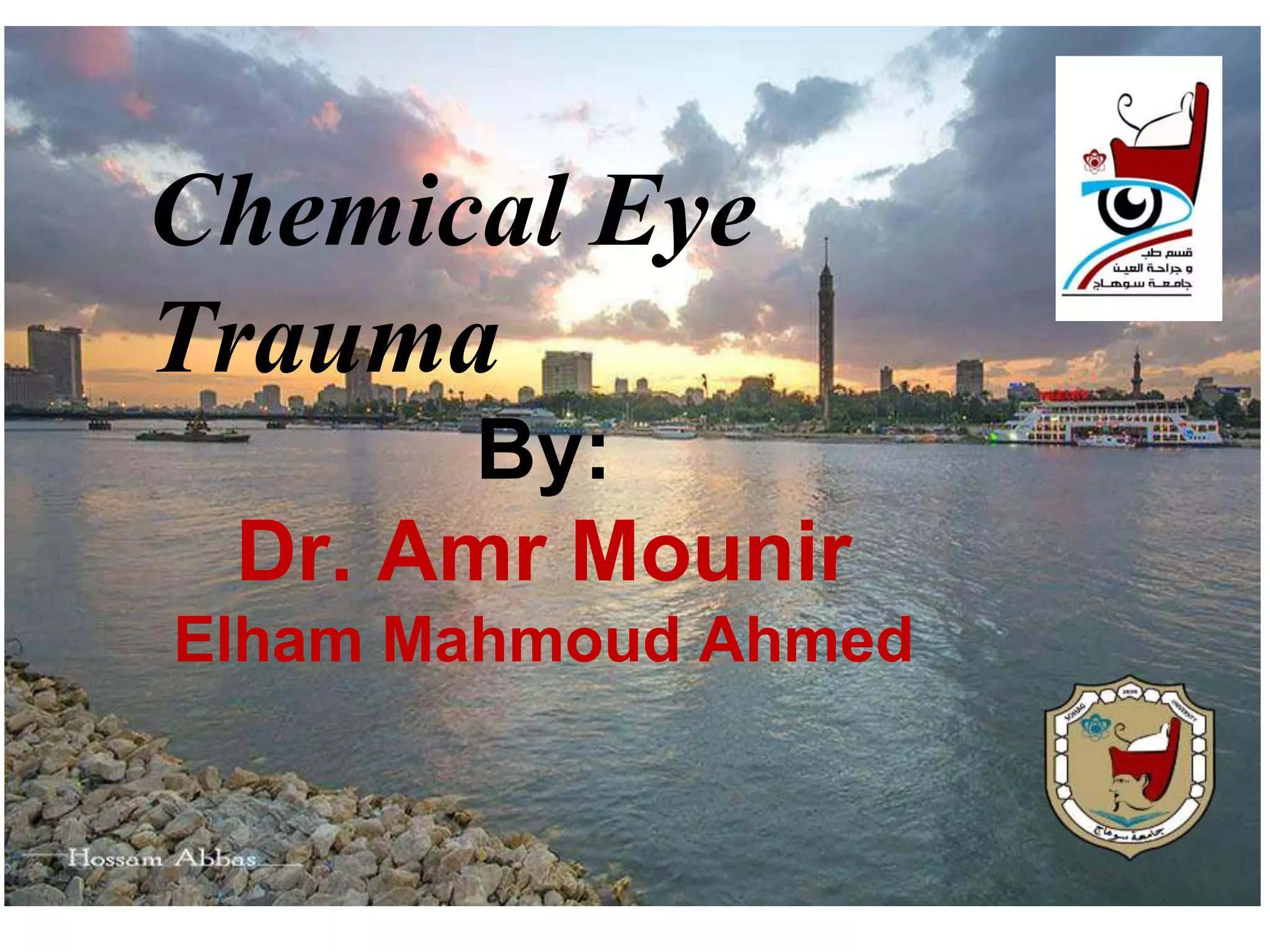 Chemical eye trauma | PPTX