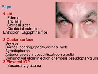 Chemical eye trauma | PPTX