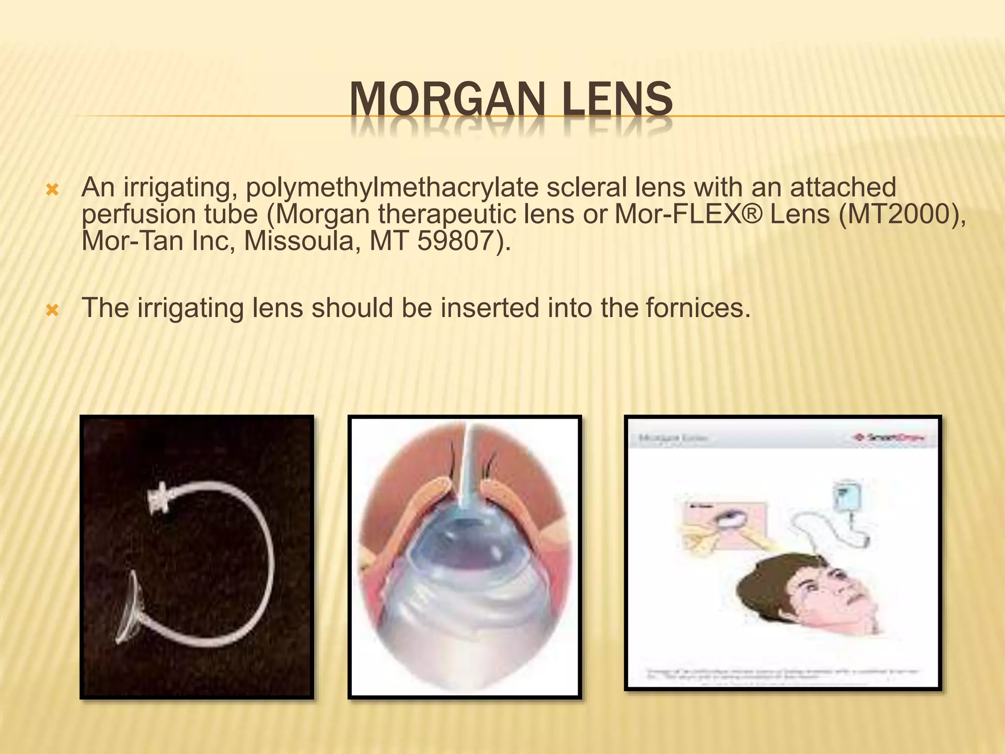 Chemical injuries | PPTX