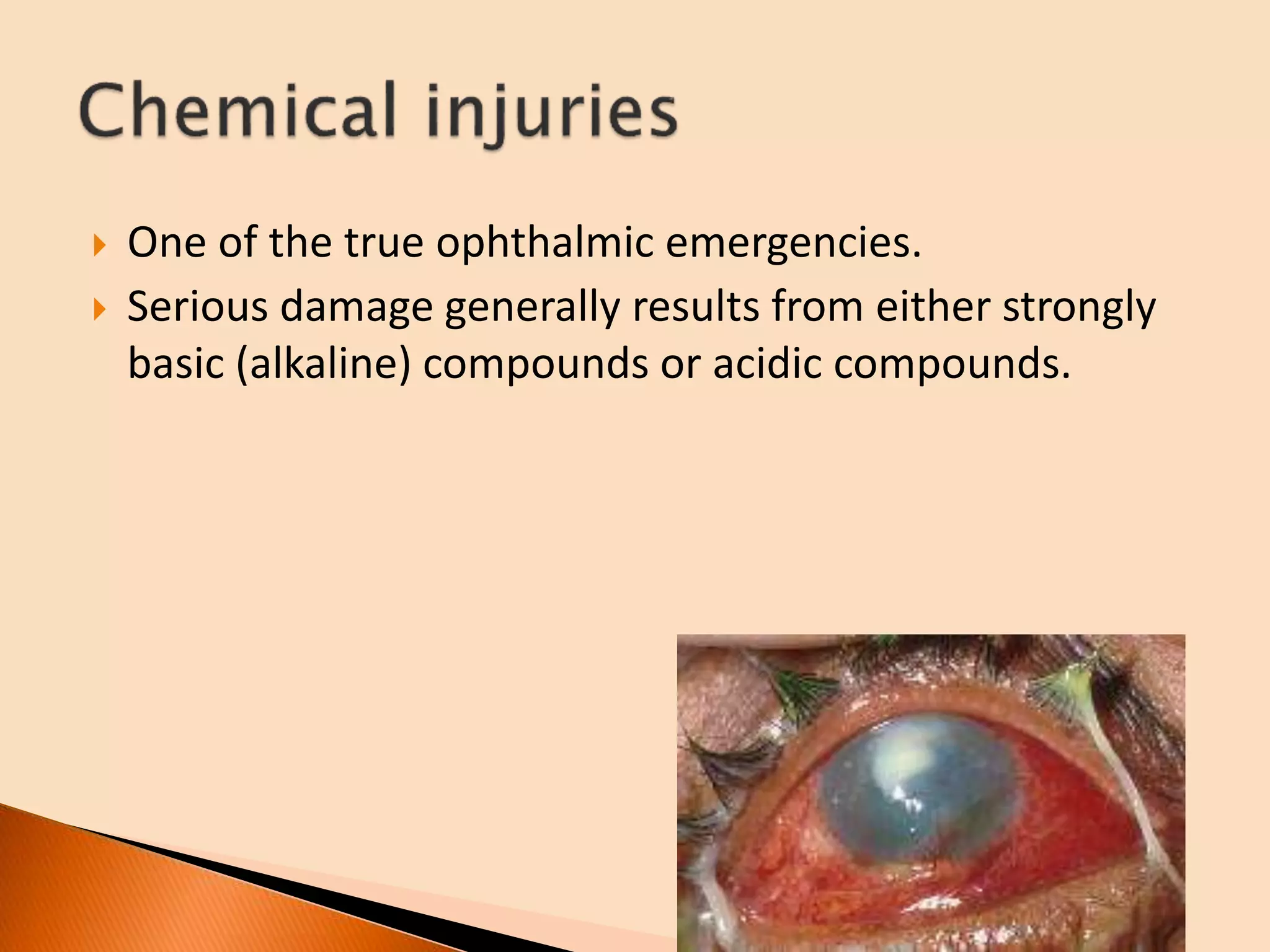 Chemical injuries | PPT