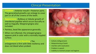 Chemical injuries On Oral Cavity | PPTX