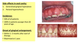 Chemical injuries On Oral Cavity | PPTX