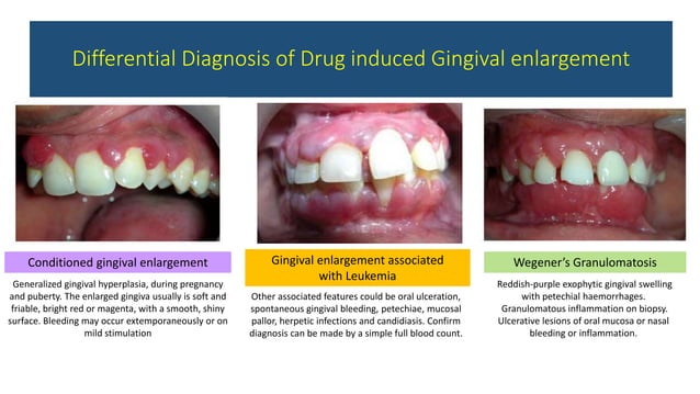 Chemical injuries On Oral Cavity | PPTX