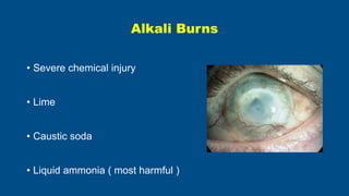 Chemical Injuries.pptx