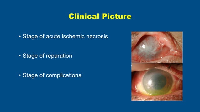 Chemical Injuries.pptx