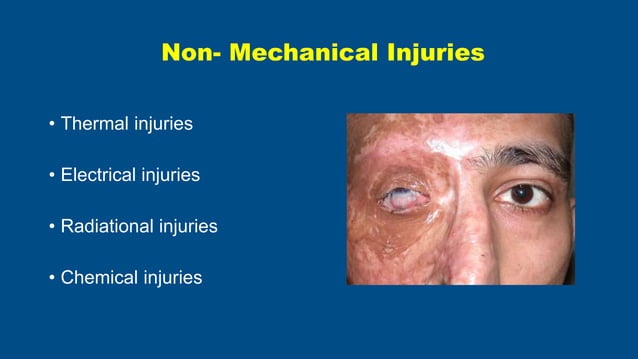 Chemical Injuries.pptx
