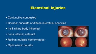 Chemical Injuries.pptx