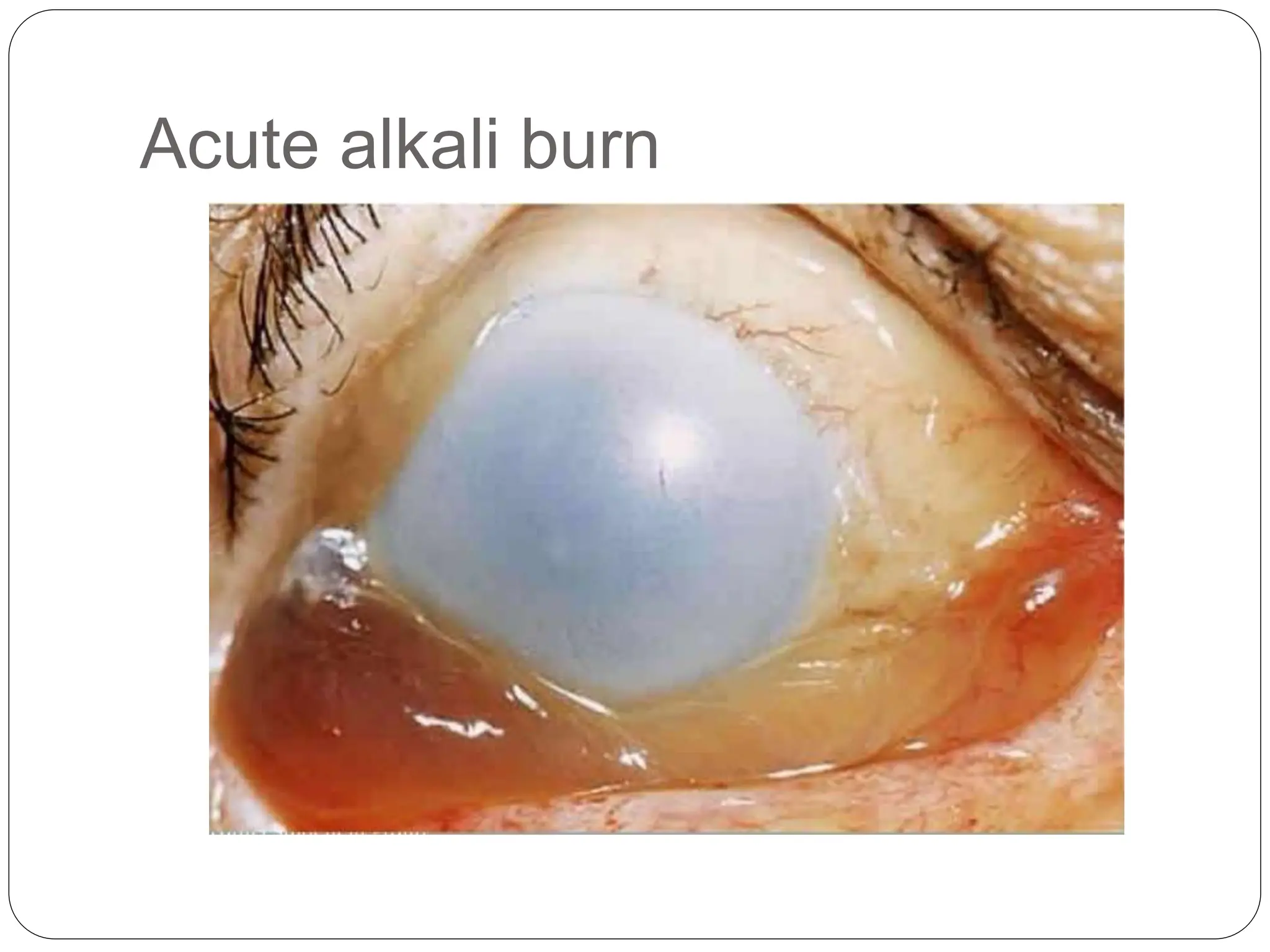 CHEMICAL INJURIES.pptx