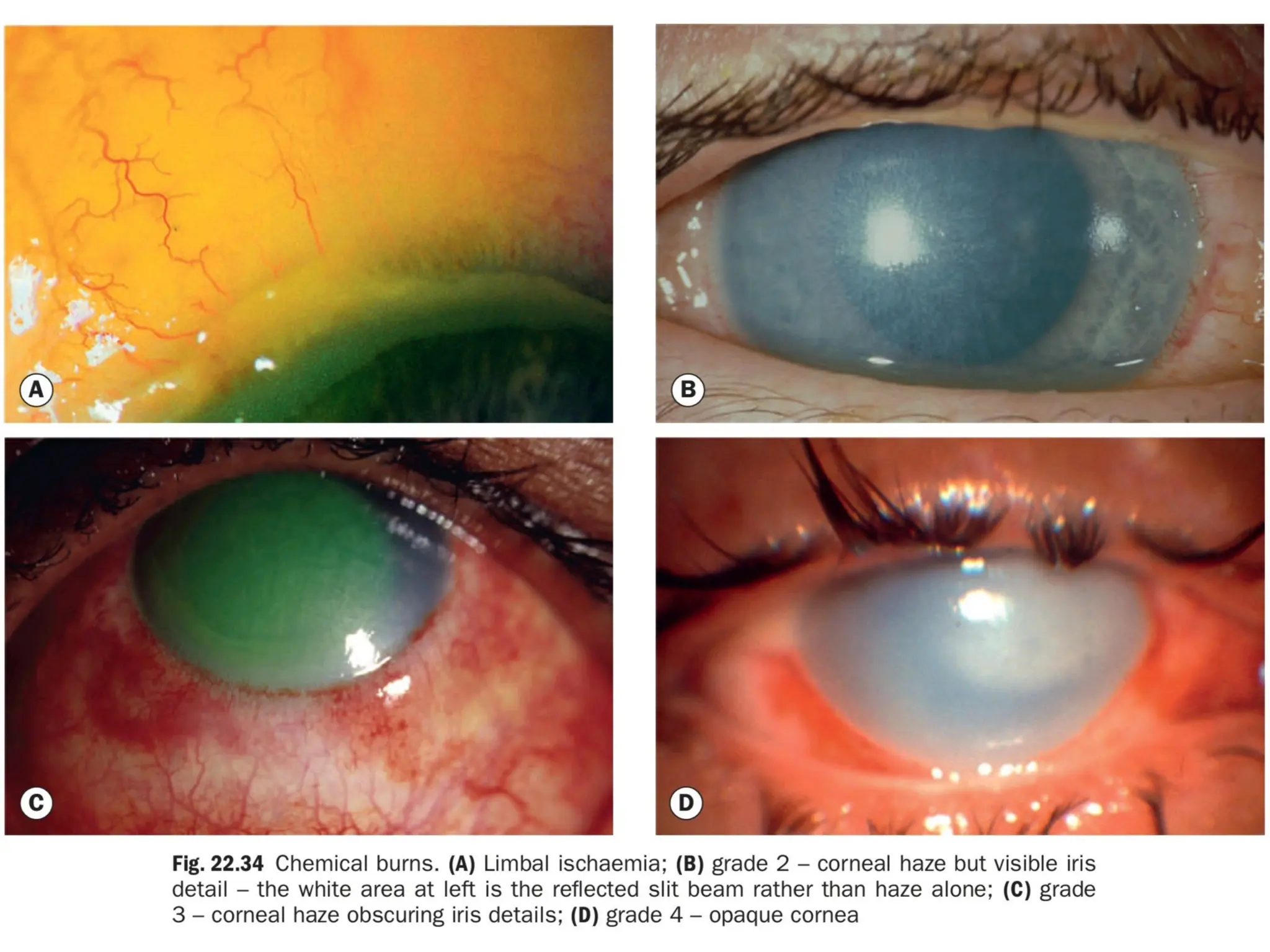 nON MECHANICAL OCULAR INJURIES .pptx