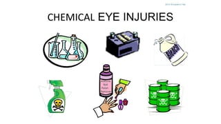 Chemical Injuries in ophthalmological view | PPT