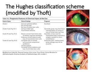 CHEMICAL INJURIES of the EYE and its management | PPT