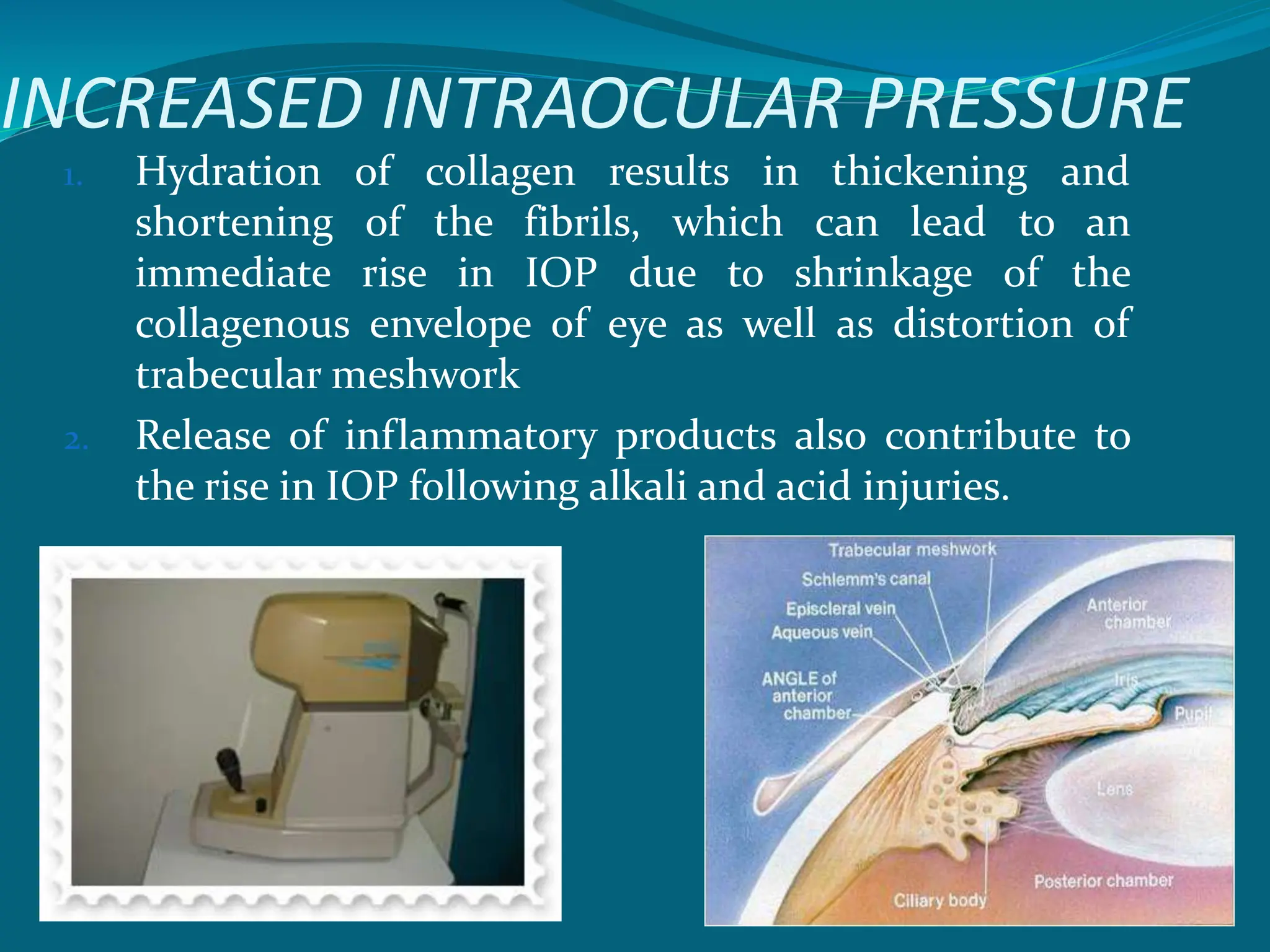 CHEMICAL INJURIES OF EYEnew.p dr manuptx | PPTX
