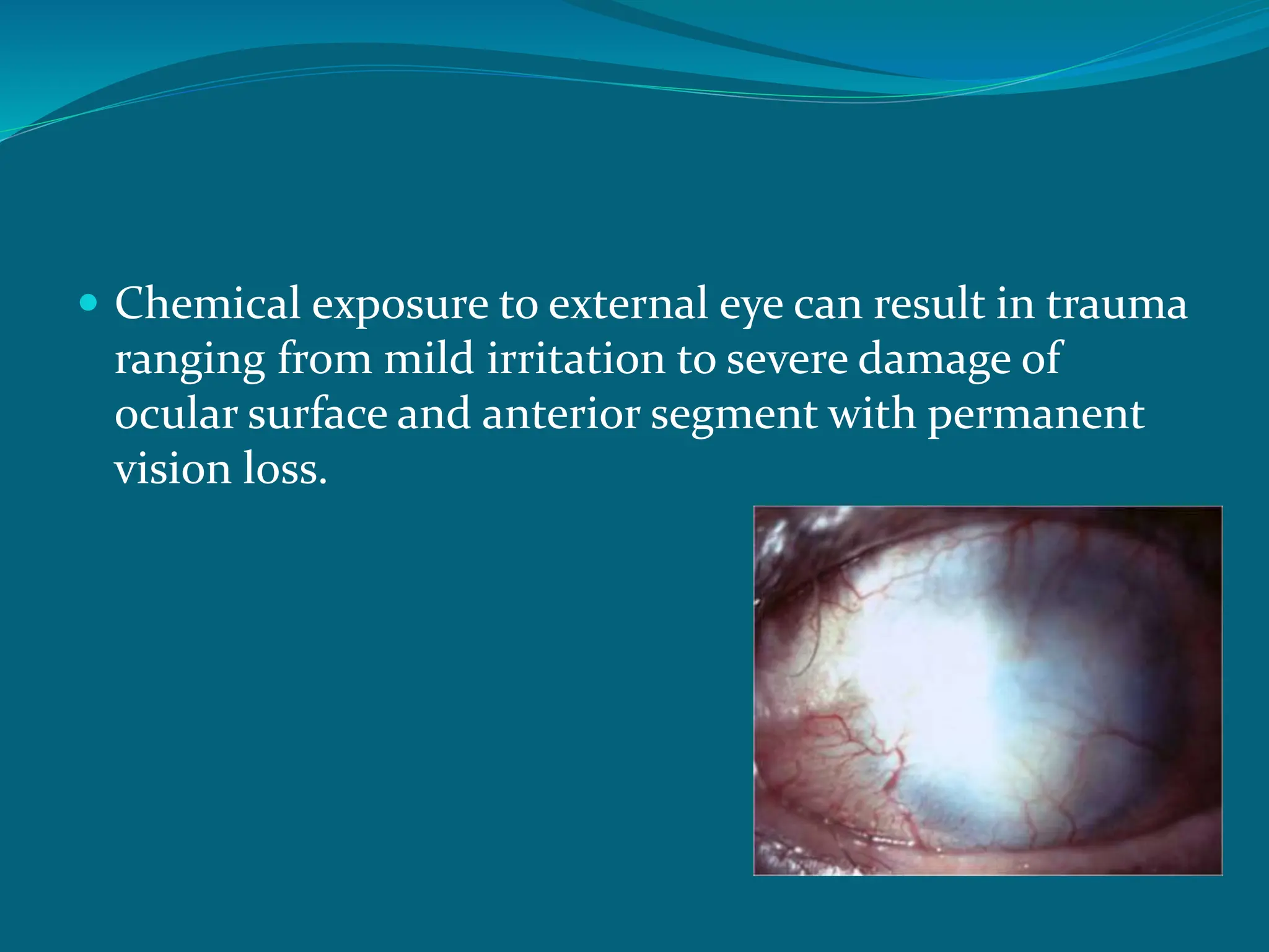 CHEMICAL INJURIES OF EYEnew.p dr manuptx | PPTX