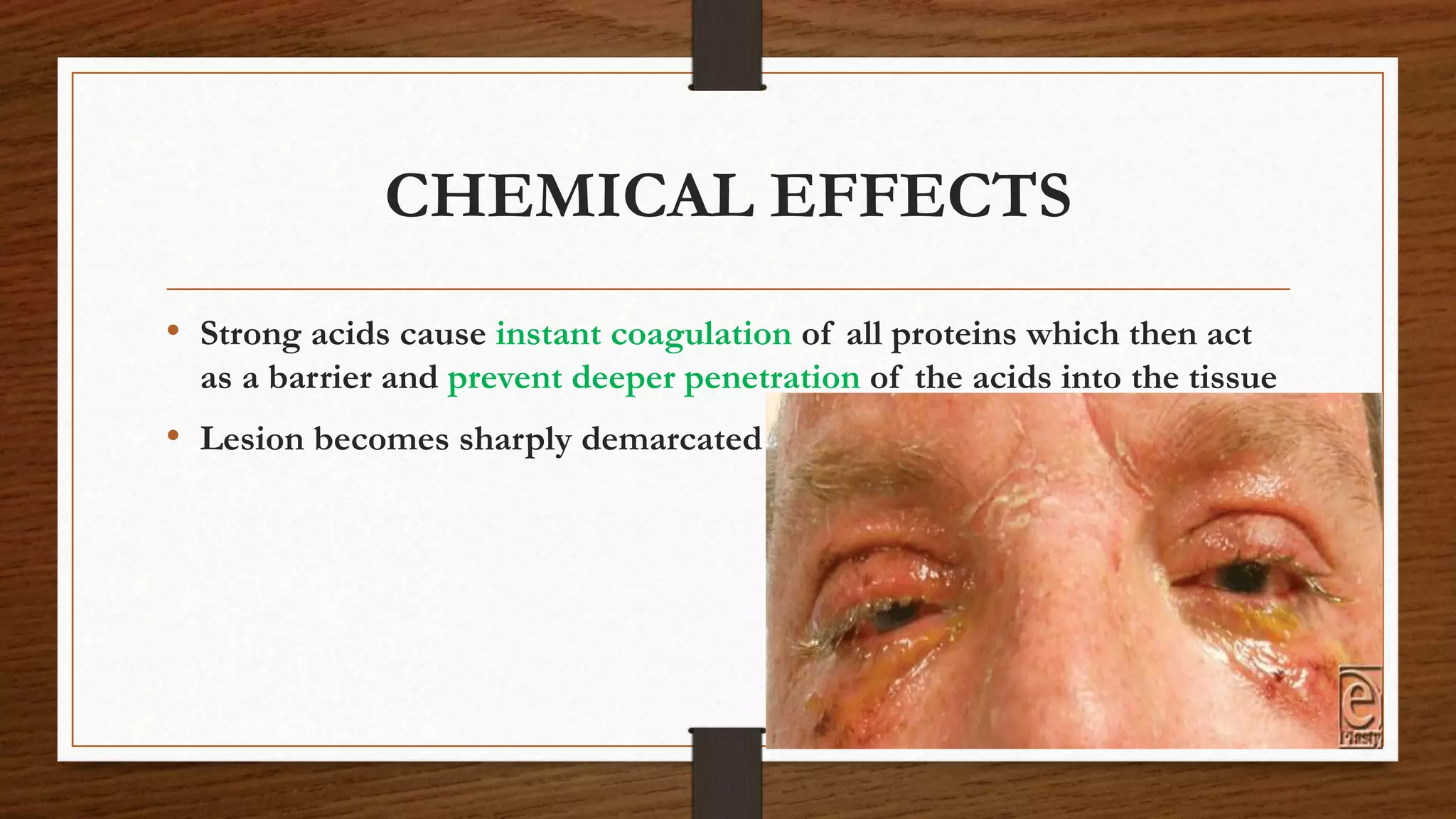 Chemical injuries of the eye | PPTX
