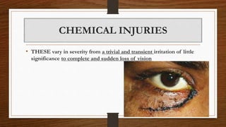 Chemical injuries of the eye | PPTX